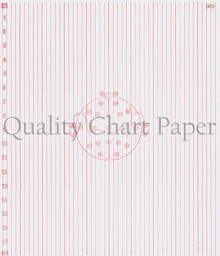 EEG Paper NICOLET 1A97 345MM X 300MM X 1000SH - Quality Chart Paper ...