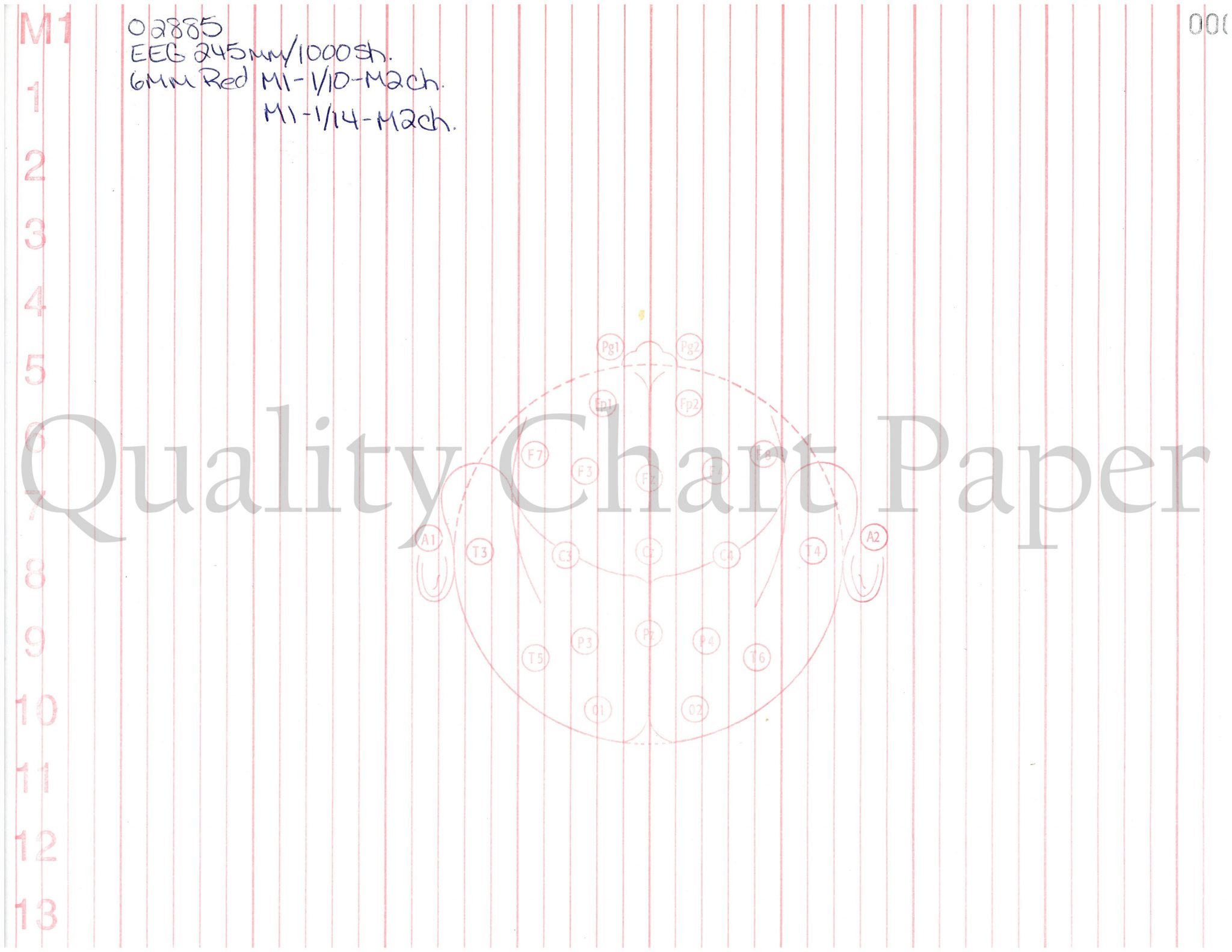 EEG Paper 245MM X 300MM X 1000 SHEETS 10/14 Channel, Fv245-30k, Head on ...