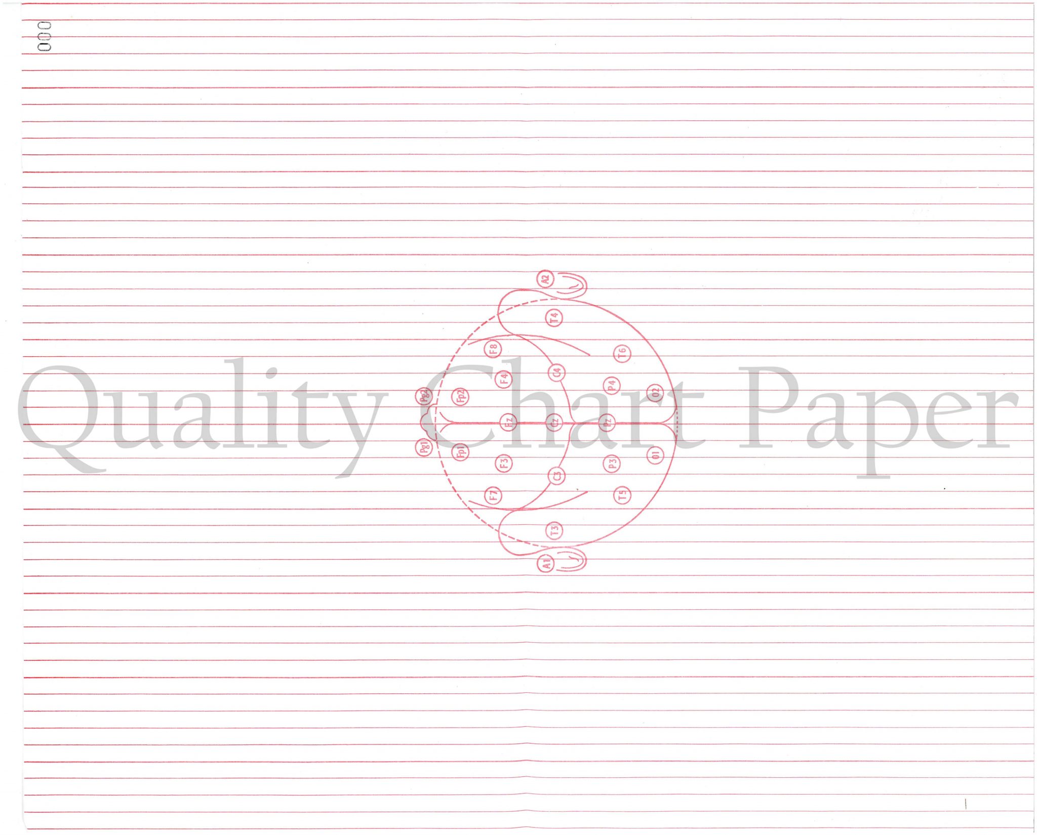 EEG Paper with 360mm X 300mm X 1000 Sheets, 6mm Red, 16 Channels, No ...