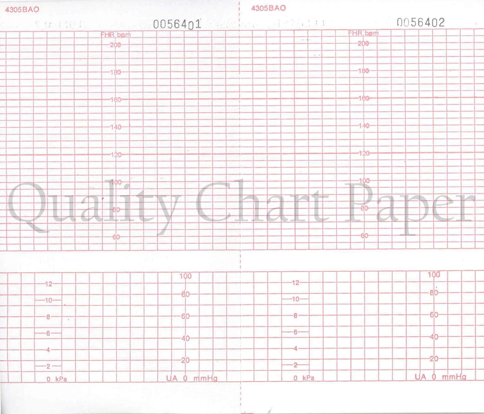 EDAN F2, F3, F6, F9 152mm X 90mm X 150sh - Quality Chart Paper - Your ...
