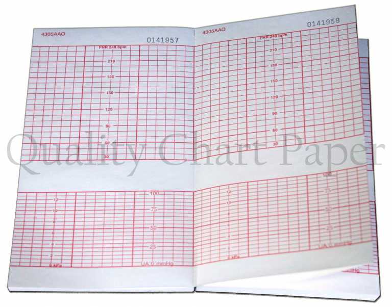 COROMETRICS 4305AAO / 4305CAO 152MM X 90MM - Quality Chart Paper - Your ...
